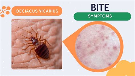 8 Type Of Bed Bug Bites Identification Chart With Picture