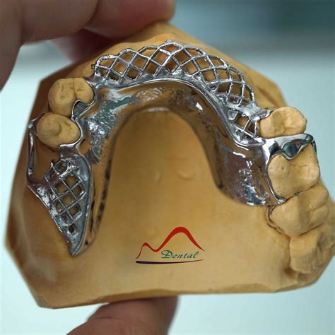 Bego Cast Partial Framework High Quality Bego Cast Partial Framework