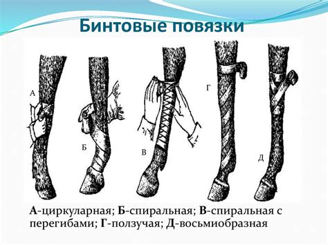 Формы перевязочного материала - online presentation