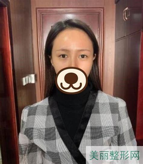 青岛附属医院整形美容科好预约吗？专家坐诊表术后果对比图~美嘉整形网美学知识