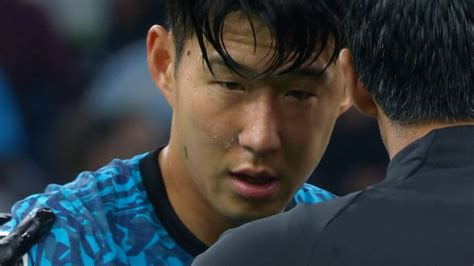 British Media Son Heung Mins Surgery Was Successful A Green Light