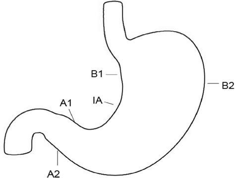 A Schematic Illustration Of Gastric Biopsies Carried Out In Present