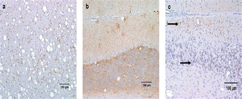 Phospho Tau Ser202 Thr205 Antibody Biotin Monoclonal At8