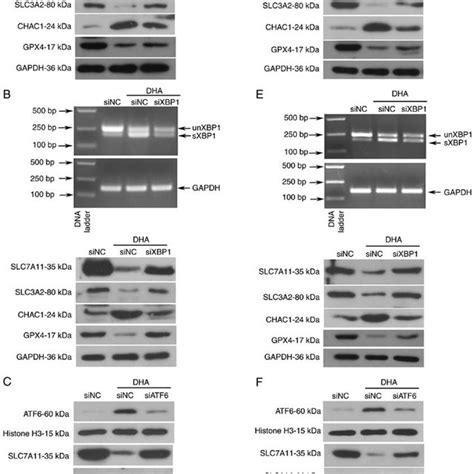 Knockdown Of Upr Proteins Partly Restores The Expression Of Molecules