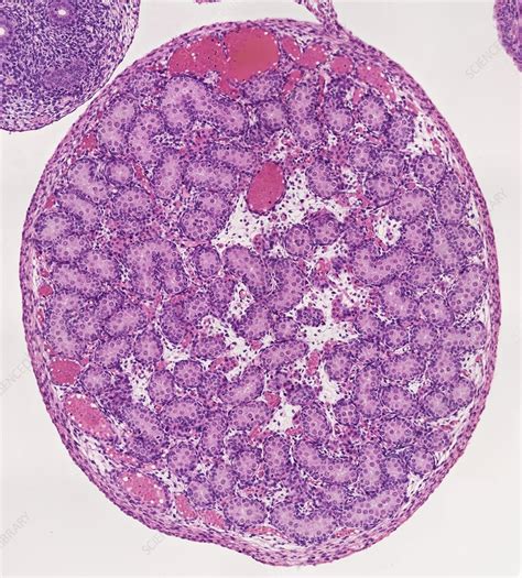 Fetal Testis Light Micrograph Stock Image C026 4053 Science