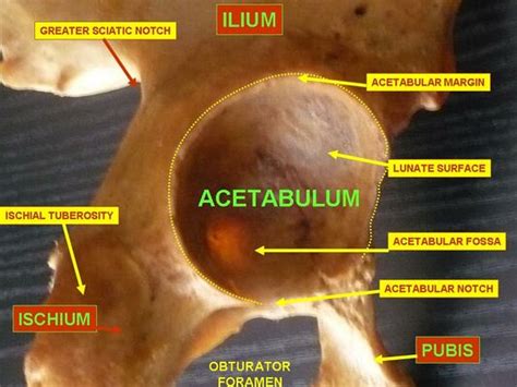Lunate Surface Of Acetabulum
