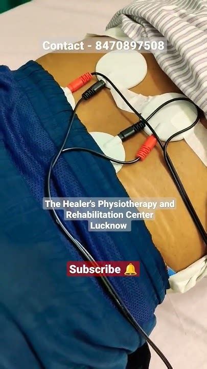 Tens Electrodes Placement For Sciatica Lumar Rediculopathy Back