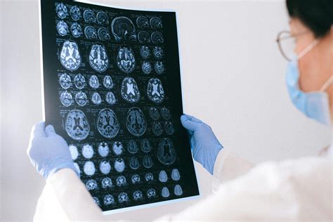 Alzheimer saiba qual o novo tipo de genético descoberto da doença