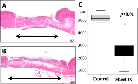 Comparing The Ulcer Diameter Histopathological Findings Of The Ulcer