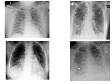 Prof Of Pulmonary Critical Care Medicine Ppt Download