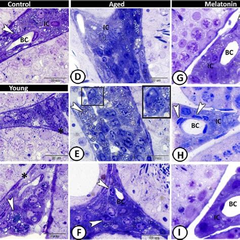 Histochemical Analysis Of Testis Of The Young And Aged Mice A In The
