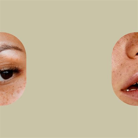 Norwest Cosmetic Surgery Western Sydney Mums