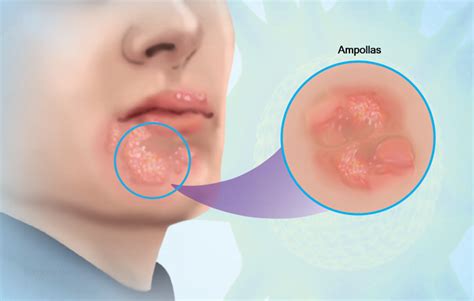 Health Condition Symptoms Causes Treatment And More
