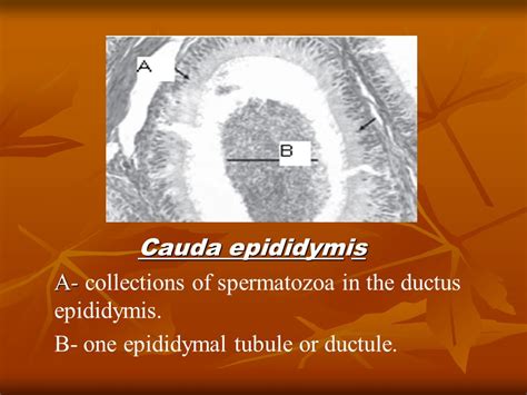 Scrotum Testes And Prostate Ppt Download