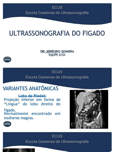 Pdf Ultrassonografia Do Figado Patologias Compress Pdf Fígado