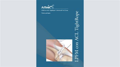 Arthrex Implante ACL TightRope