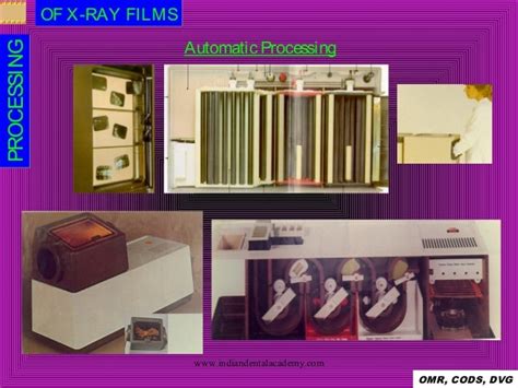 X Ray Image Processing