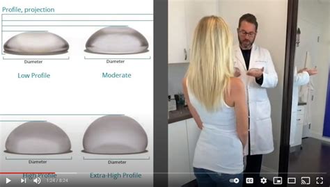 Breast Augmentation Before And After High Profile
