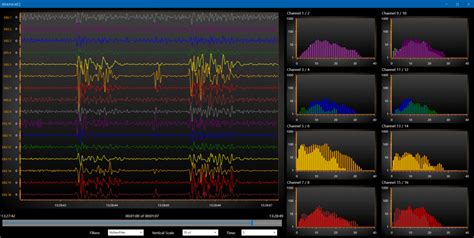 BrainHat Viewer OpenBCI Community