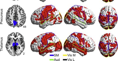 Heres Your Brain On Lsd