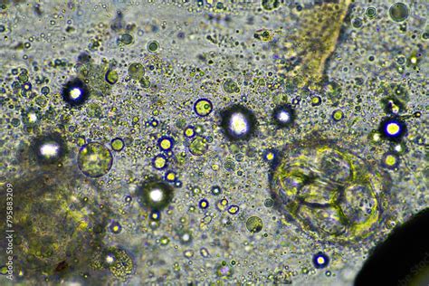 Green Mucus And Coughing Up Phlegm Under The Microscope Looking At