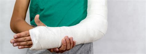 Adaptive Clothing For A Broken Arm How To Get Dressed With A Broken Arm