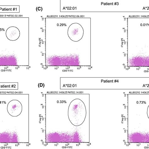 Htlv‐1 Tax‐specific Ctls In Four Patients With Aggressive‐type Atll