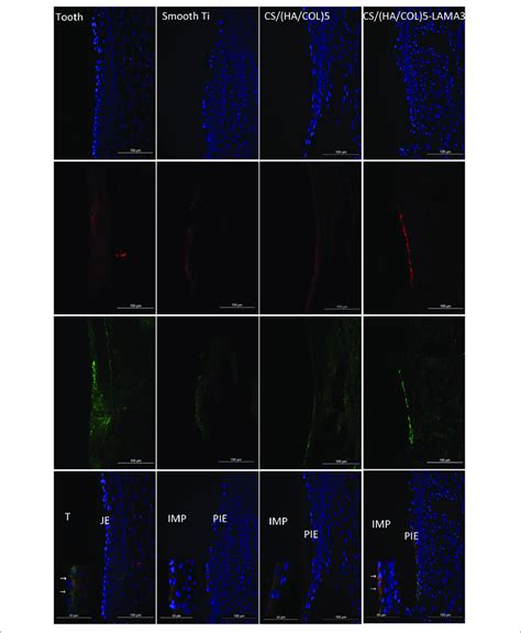 Immunofluorescent Microscopy Expression Of Laminin α3 And Integrin β4 Download Scientific