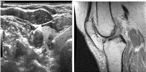 논문 리뷰 Towards Optimal Convolutional Transfer Learning Architectures
