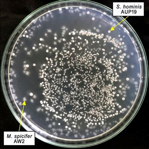 Fatty Acid Methyl Esters Fame From Esterification And Download