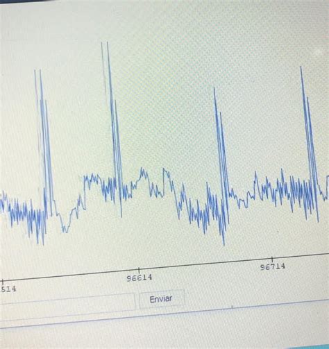 Analog Read With Arduino And Nodemcu Esp8266 · Issue 7407 · Esp8266arduino · Github