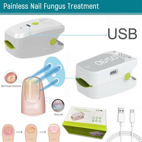 905NM Nail Fungus Laser Nail Treatments Device USB Charging Light