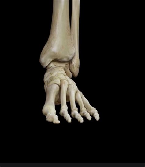 Pasión por la Anatomía on Twitter El juanete o Hallus valgus hallux