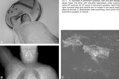 Figure 1 From Lower Neck And Thoracic Inlet Swimmers Ct Improved