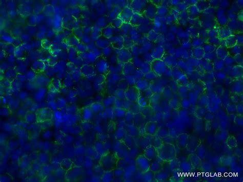 Hla Drb4 Antibody 83103 1 Pbs Proteintech