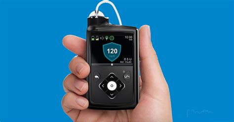 New Technology From Medtronic Diabetes