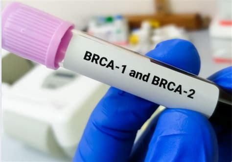 BRCA Gene Variants Meaning Beyond Breast Cancer DetecTogether