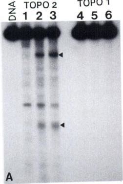 Comparison Of Intoplicinc Induced Topo I And II Mediated DNA Cleavage