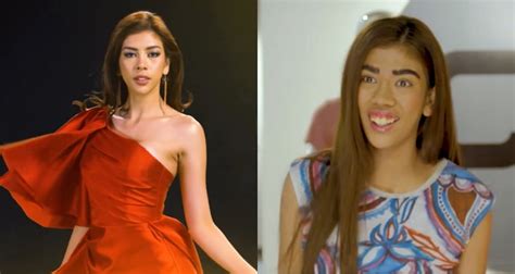 Herlene Budol Had Minor Accident During Taping For Magandang Dilag