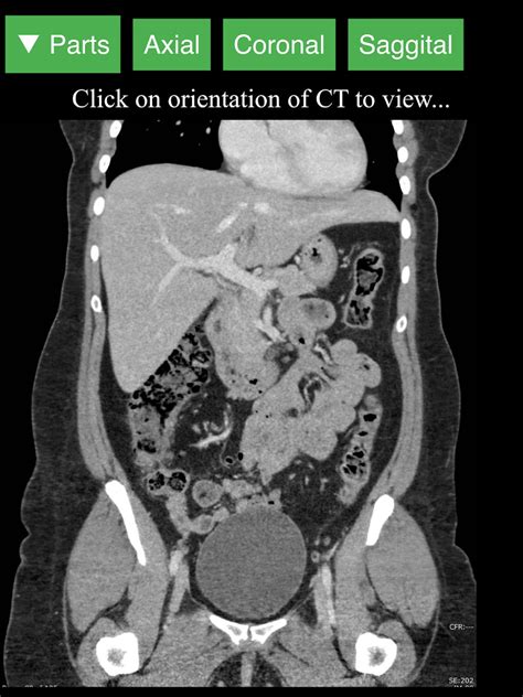 Android 용 Radiology Ct Viewer Apk 다운로드