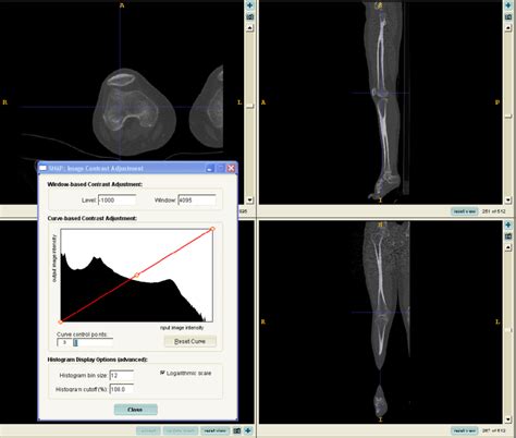 3 image navigation and volume histogram with itk snap download
