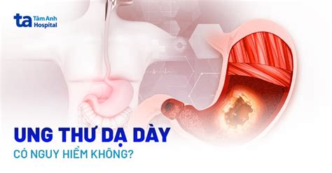 U vú là dấu hiệu bệnh gì Khối u ở ngực có nguy hiểm không