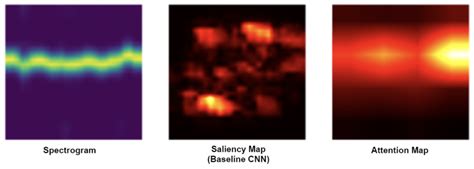 Convolutional Neural Network With Attention On Spectrograms For Emotion Detection Prof