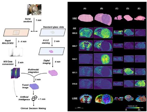 Spatial Metabolomics In Oncology Transforming Cancer Diagnostics With Mass Spectrometry Imaging
