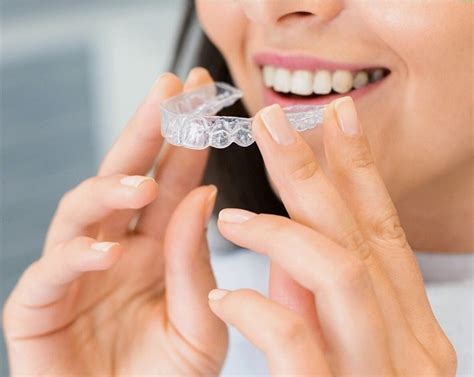Spark Aligners In Bangalore Advanced Clear Braces