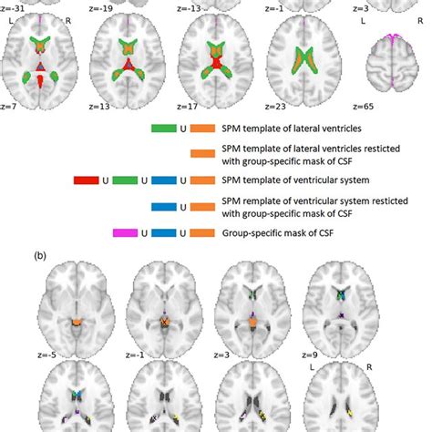 Schematic Pipeline Depiction Of Fmri Data Preprocessing And Computation