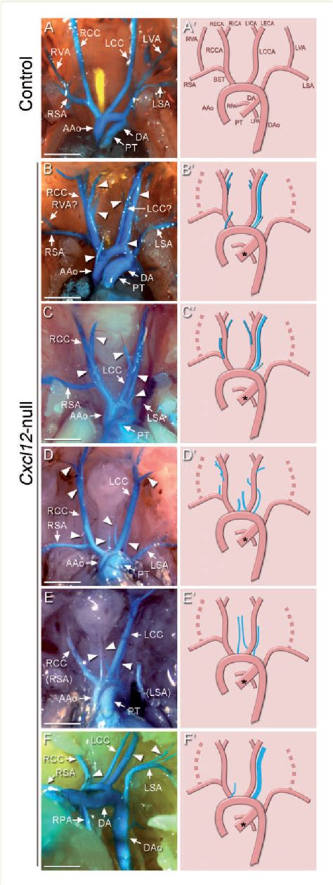 Structure Of Thyroidea Ima Artery Semantic Scholar