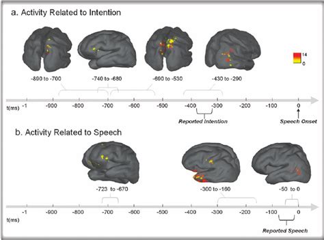 a spatiotemporal dynamics of reconstructed sources of brain