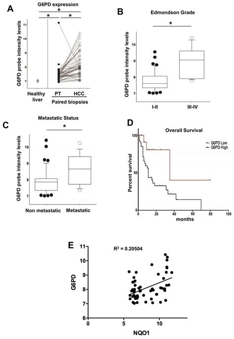 G6pd Is Up Regulated In Biopsies From Human Hccs And Correlates With