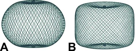 The Safety And Effectiveness Of The Woven Endobridge Web System For The Treatment Of Wide